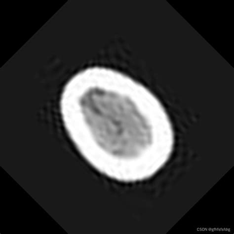 0073期通过cnn卷积网络识别ct图 含数据集cnn识别轮廓 Ct图像 Csdn博客
