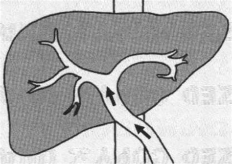 Dms 103 Hepatic Vasculature And Doppler Flashcards Quizlet