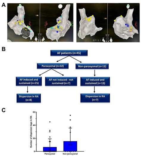 Po 03 130 Role Of The Right Atrium In The Maintenance Of Paroxysmal And Non Paroxysmal Atrial