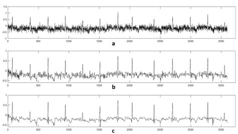 Comparison Of The Denoising Techniques Applied To The Signal 100 Of The Download Scientific