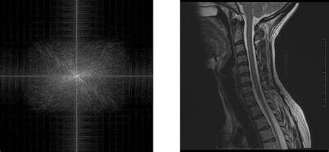 K Space Radiology Cafe