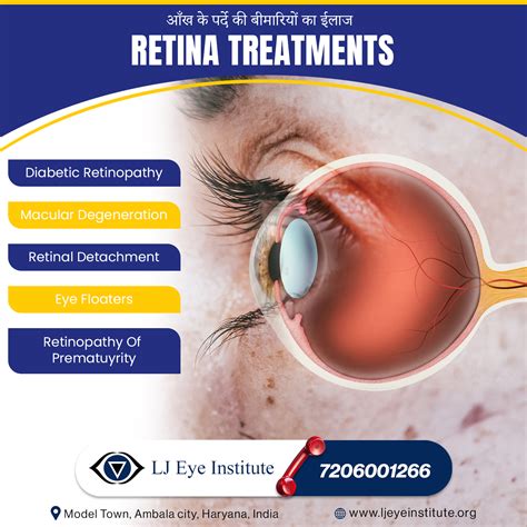 Central Serous Chorioretinopathy Cscr Lj Eye Institute