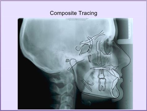30 40 Cephalometric Imaging And Analysis Product Details Orthotraining