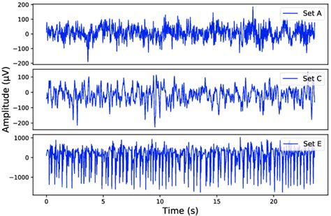 Eeg Signals At Healthy Inter Ictal And Ictal States Download Scientific Diagram