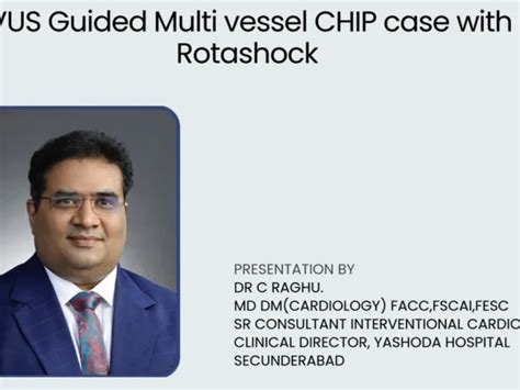 Left Ventricular Ejection Fraction Lvef Dr C Raghu