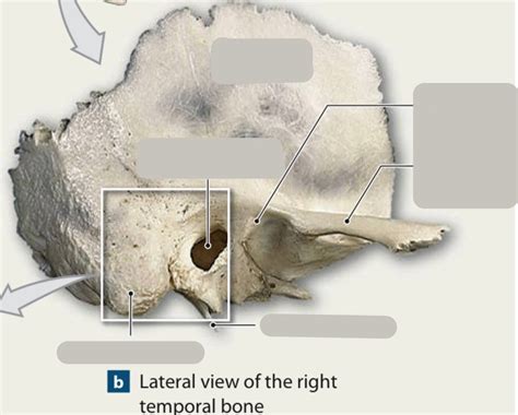 Lateral View Lateral View Of The Right Temporal Bone Diagram Quizlet