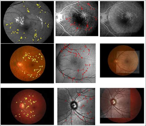 Non Uniform Distribution Of Features Original Sift Point Detector In Download Scientific