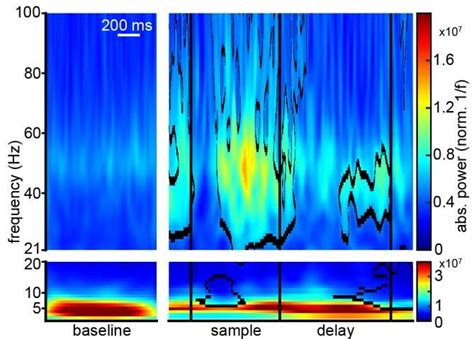 Average Time Frequency Power Of Lfp Of A Single Electrode Of A Single