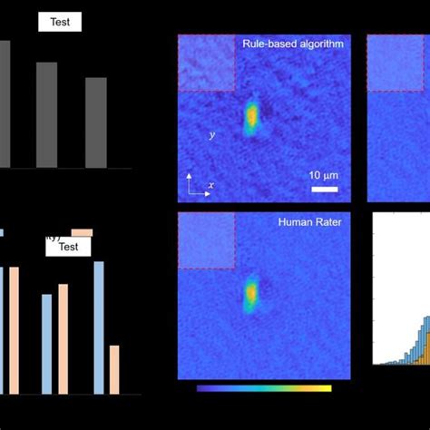 Performance Of Deep Learning Human Raters And Rule Based Algorithm On
