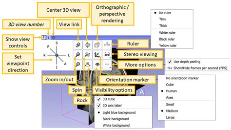 sparc microct exercise 1 md at main · castuofa sparc microct · github