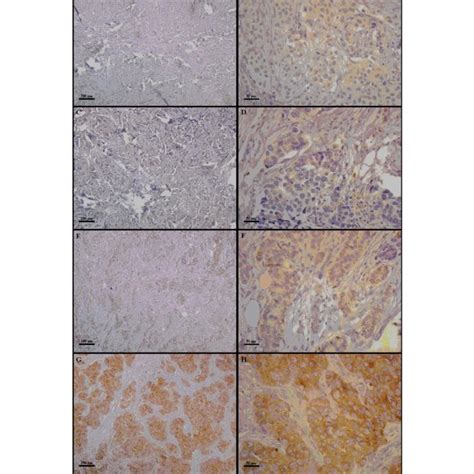 The Right Column Indicates 100× Magnification And The Left Column