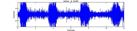 The Original Waveform Of Asthma State Download Scientific Diagram