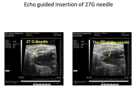 Mouse Echocardiography Echo Guided Intraventricular And Intramyocardial Injection Ppt