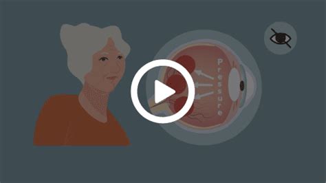 Improve Glaucoma Management With The Reteval Handheld Erg Device