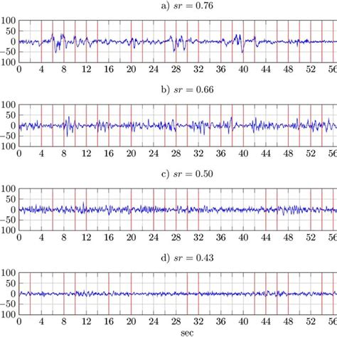 Segmentation Results Segment Rates Sr For Different Eeg Patterns A Download Scientific