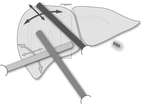 Ultrasound Scanning Techniques Pmc