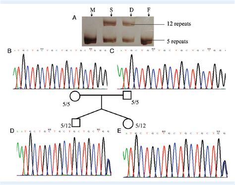 Figure 2 From Alterations In The Frequency Of Trinucleotide Repeat