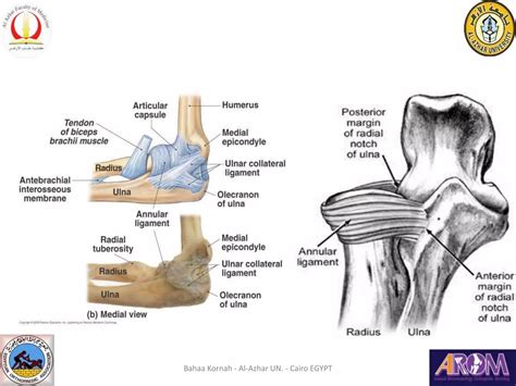 Radial Head Fracture Ppt
