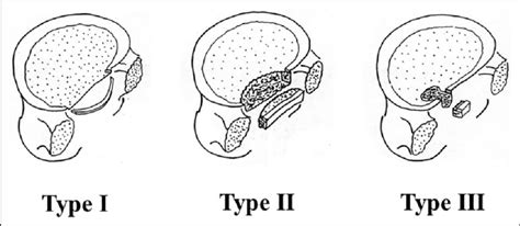 Takatas Classification Download Scientific Diagram