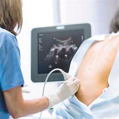 УЗИ аппарат Philips Sparq ультразвуковая диагностика узи сканер Филипс НДА