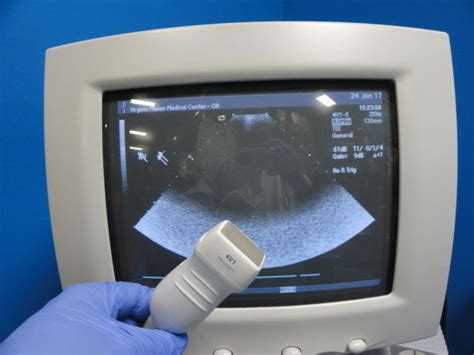 Acuson 4v1 Vector Array Ultrasound Probe For Acuson Sequoia And Aspen Acuson 4v1 Vector Array Ultrasound Probe For Acuson Sequoia And Aspen