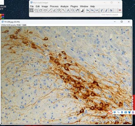 用imagej 免疫组化及荧光强度的分析？ 知乎