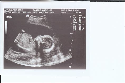 Scan0007 Turtle 4 U2002 Flickr