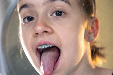 Free Photo Caucasian Girl With Braces On Her Teeth Looking At The Mirror