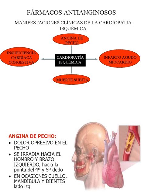 Fármacos Antianginosos Y Su Uso Clínico Pdf Droga Anti Inflamatoria