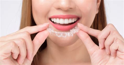How Does Invisalign Work Perfect Dental
