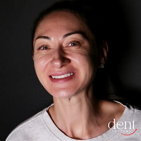 دينت اناتومي Home