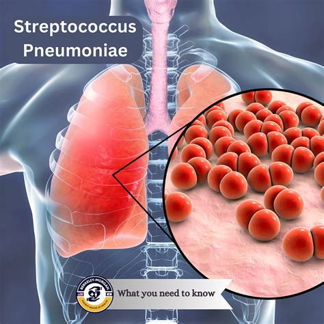 093025 Public Health Education Topic Streptococcus Pneumoniae