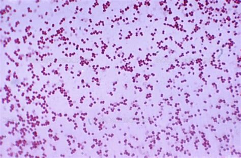 Moraxella Catarrhalis Scheda Batteriologica Ed Approfondimenti