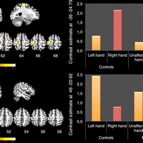 Main Effect For The Motor Execution And The Motor Imagery Task Brain Download Scientific