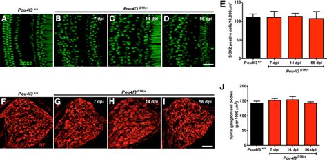 Cochlear Supporting Cells And Sgns Are Not Affected By Dt Mediated Hair