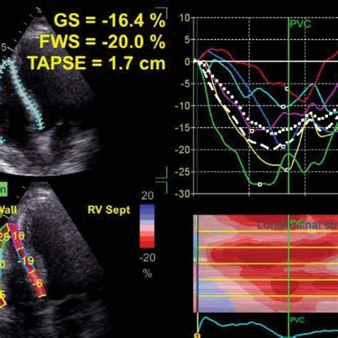 3v Volumes And Rv Ef Calculation Using Dedicated Software Download