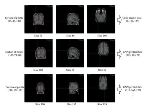3d Sample Voxel Slice Images Three Slices Xy Yz Xz Classification Download Scientific
