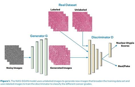 Intel Helped Researchers Develop An Ai Based Model That Detects Breast Cancer More Accurately