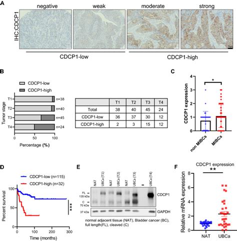 Cdcp1 Expression Is Frequently Increased In Aggressive Urothelial