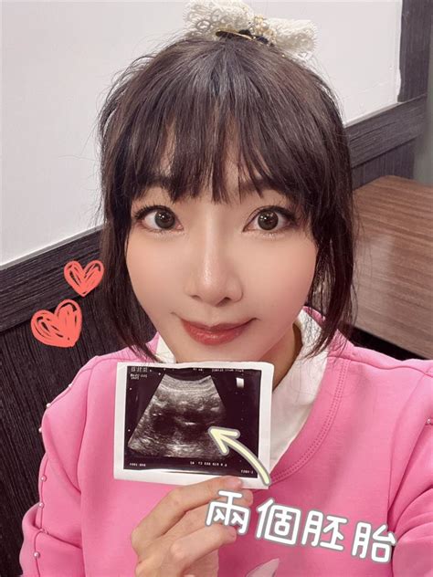 恭喜！資生堂千金成功植入2胚胎「3寶媽懷雙胞胎」高齡產婦龍年拚5寶媽 娛樂星聞
