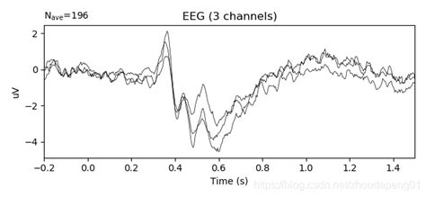 python中mne库的eeg数据（pca和ica）预处理 mne库运行pca代码 csdn博客