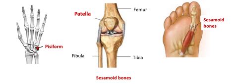 Classification Of Bones Anatomy Qa