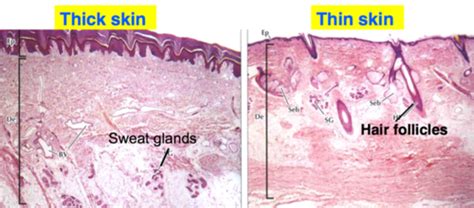 Integument System Lecture Flashcards Quizlet