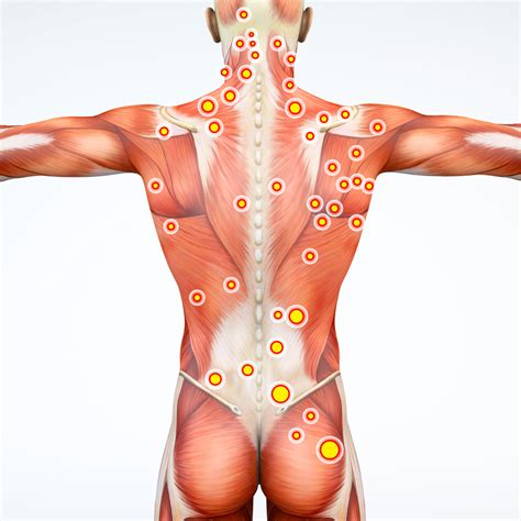 Diagnosis Of Trigger Points In Beverly Hills Ca