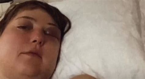 בפנים נפוחות גאלה קוגן יצאה מניתוח להסרת הגידול בראשה Tmi