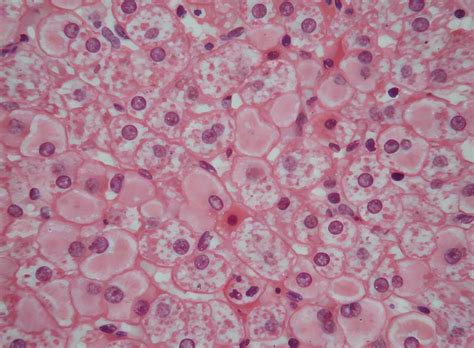 What Is A Plate Count In Microbiology Lab Testing Guide
