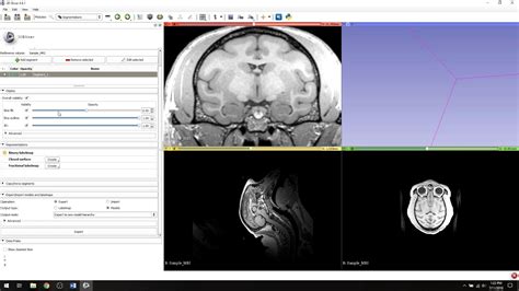 9 3d Slicer Exporting Segmentation To Models Youtube