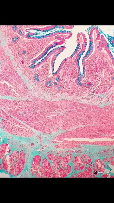 Jejunum Vs Ileum Histologi Chemotherapie Na De Operatie Dikke
