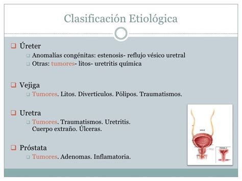 Hematuria