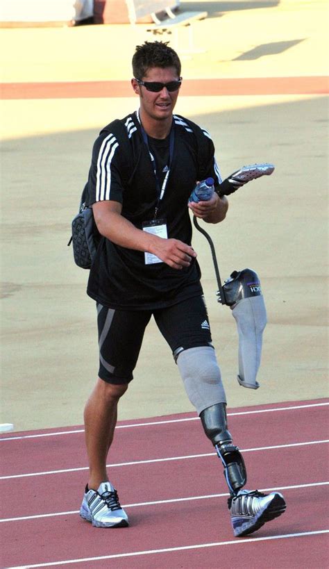 Physical Therapy Guide To Below Knee Amputation Transtibial Amputation Artofit